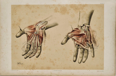 Anatomical Drawing 19th Century - Human Hand Dissection (plate X) Ford ...